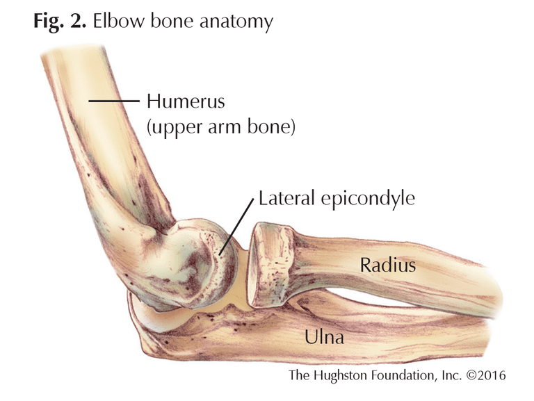 Taming Tennis Elbow - Hughston Clinic