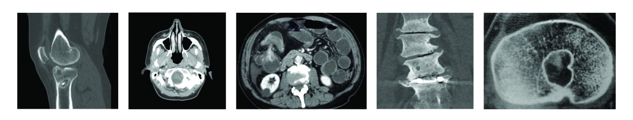 Orthopedic Imaging - Hughston Clinic