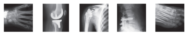 Orthopedic Imaging - Hughston Clinic