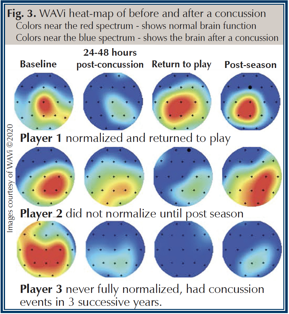 Concussion Software - Hughston Clinic
