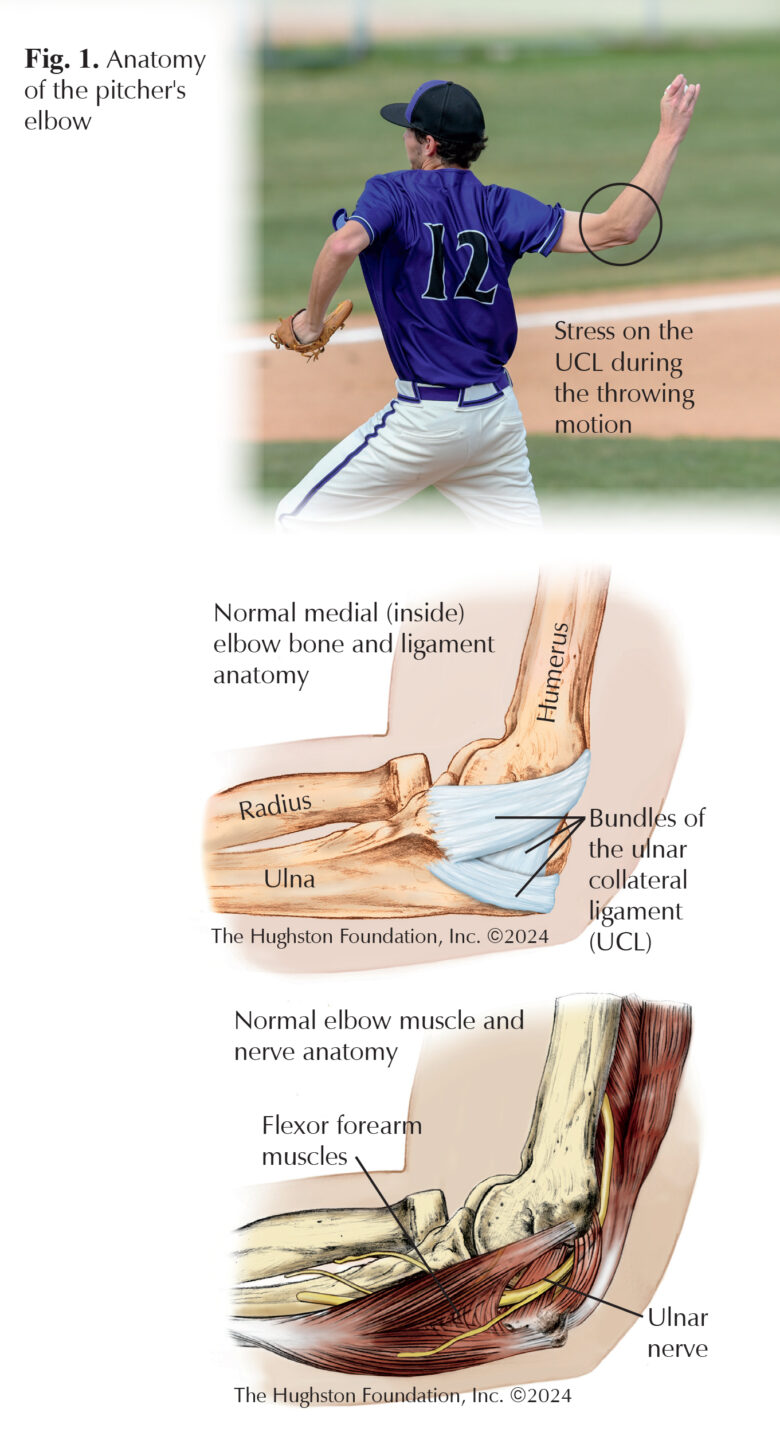 Tommy John Surgery Information | UCL Repair Resources